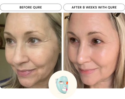 World's First Customizable LED Light Therapy Mask – Qure Skincare