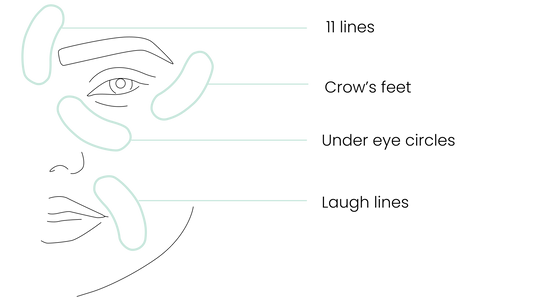 Micro-Infusion Targeted Patches (8 Pairs) – Qure Skincare