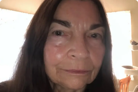 Anti-Aging Serum | All In One Solution For Wrinkles | Qure