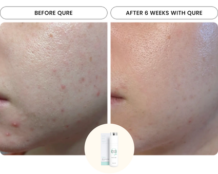 All-In-One Face Serum – Qure Skincare